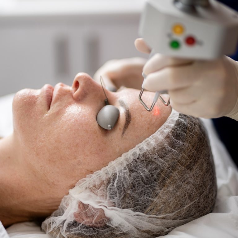 CO2 DOT Laser - SkinBox Clinics