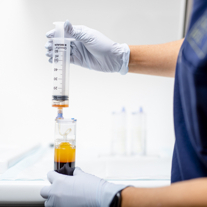 Hair Regeneration | Emcyte® | SkinBox in East Fremantle